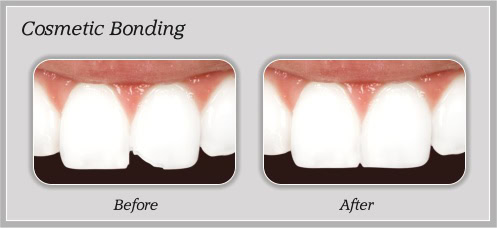 Smile Gallery - Refresh Smiles